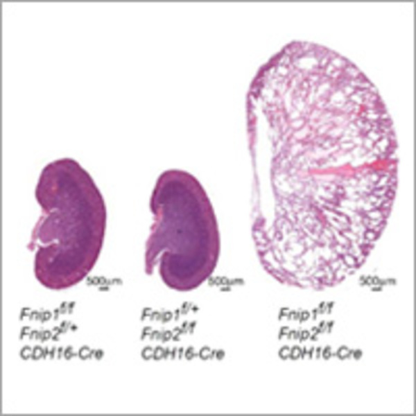 Tumor suppressor function of the Flcn/Fnip1/Fnip2 protein complex ...