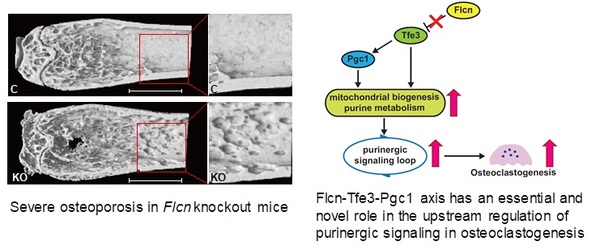 Folliculin regulates osteoclastogenesis through metabolic regulation ...